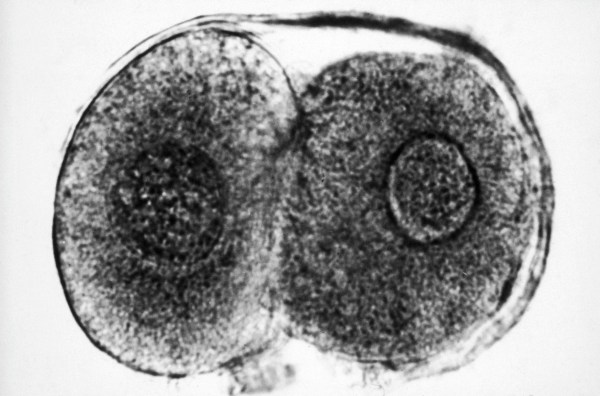 Zygote | The Book of Jezebel Excerpts | TIME.com